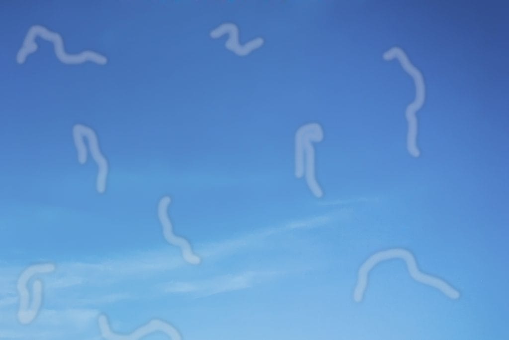 Eliminate Floaters Wilmington NC | Advanced Laser Treatments